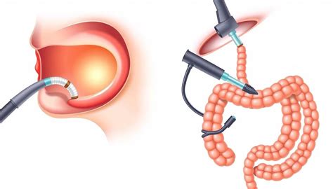 Endoscopy Vs Colonoscopy Key Differences And When You Need Each