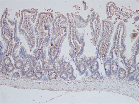 免疫组化ihc 湖南慧登生物科技有限公司