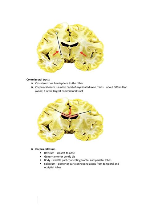 Neuroanatomy Notes Anat 242 Neurobiology Otago Thinkswap
