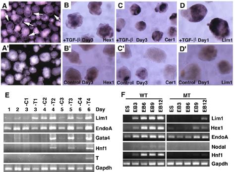 Figure 1 From Anterior Visceral Endoderm Smad4 Signaling Specifies Anterior Embryonic Patterning
