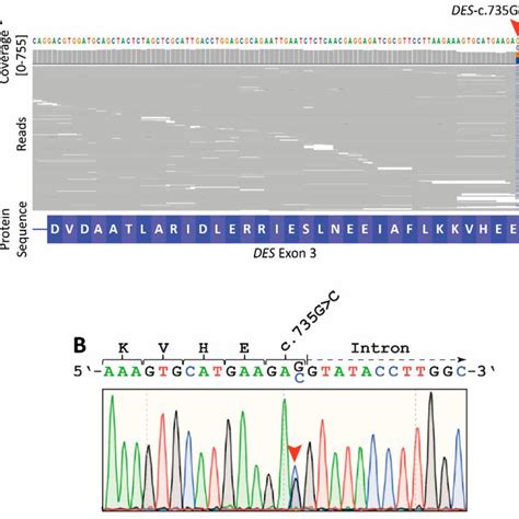 Genetic Analysis Of The Index Patient Iii 9 A Integrated Genome