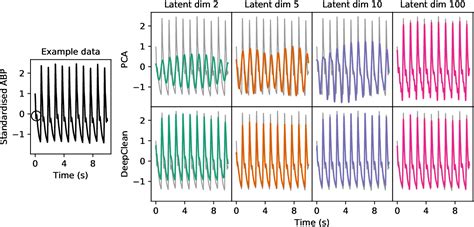 Figure 4 From Deepclean Self Supervised Artefact Rejection For