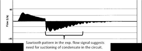 Respiratory Distress On The Ventilator Cancer Therapy Advisor