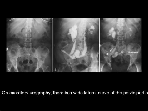 Imaging Of Urinary Bladder And Urethra Pptx Medical Tests Medical