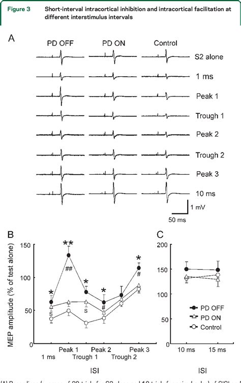 Figure 3 From Increased Motor Cortical Facilitation And Decreased Inhibition In Parkinson
