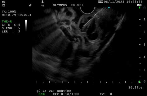 Eus Eu Olympus Olympus Abed Allehibi