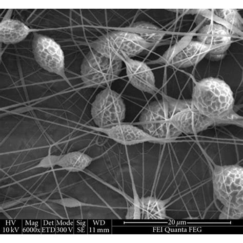 A Tem Of Core Shell Fibers Prepared By Coaxial Electrospinning