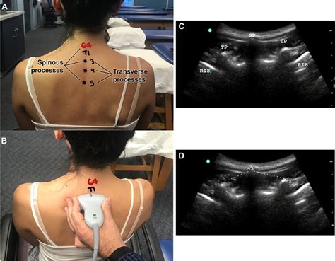 A Demonstration Picture Showing How The Subjects Are Marked The C7 Download Scientific