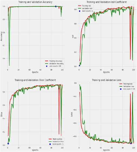 figure 6 from brain disease detection using pspnet for multiclass segmentation semantic scholar