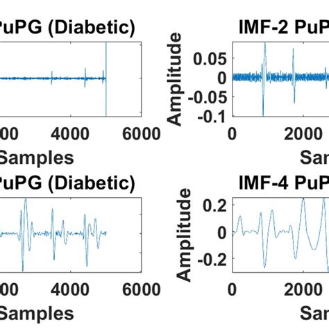 first four intrinsic mode functions of a non diabetic signal