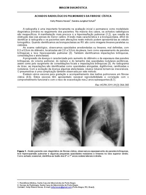 Achados Radiológicos Pulmonares Da Fibrose Cística Pdf