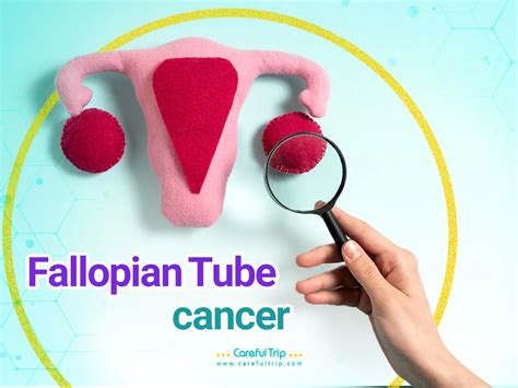 Fallopian Tube Cancer 11zon Webp