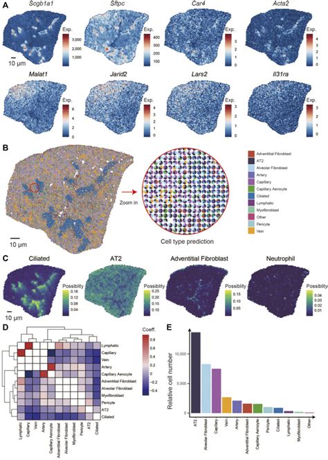 Spatial Transcriptome Uncovers The Mouse Lung Architectures And