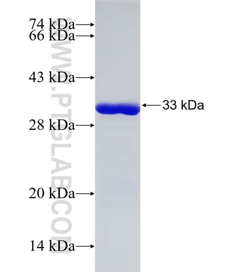 Masp1 Fusion Protein Ag31877 Proteintech