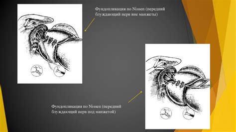 Операции фундопликации Online Presentation