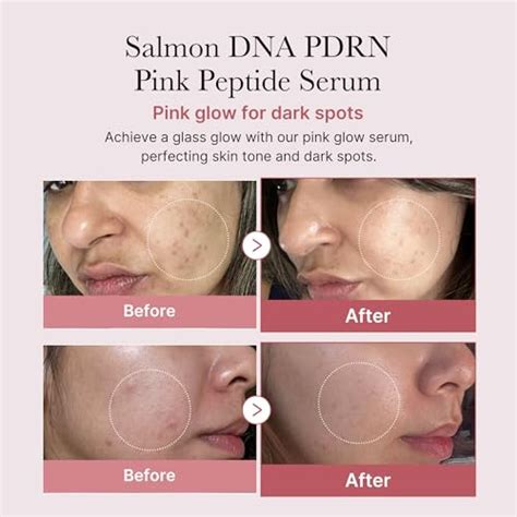 Medicube Salmon Dna Pdrn Pink Trio Set Salmon Dna Pdrn Pink Peptide