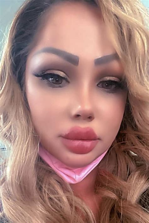 360 Best Big Lips Images On Pholder Botchedsurgeries Makeup