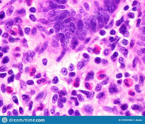 Human Appendix Eosinophils Stock Image 270581083