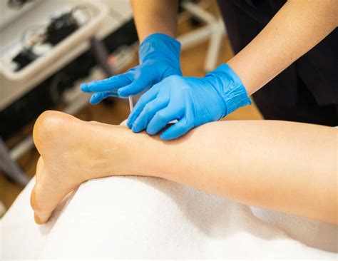 The Ultimate Guide To Dry Needling For Sciatica