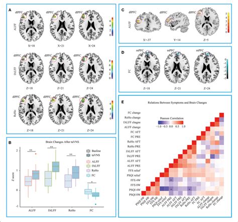 A Different Voxel Based Analyses Showed Similar Up Regulated Area