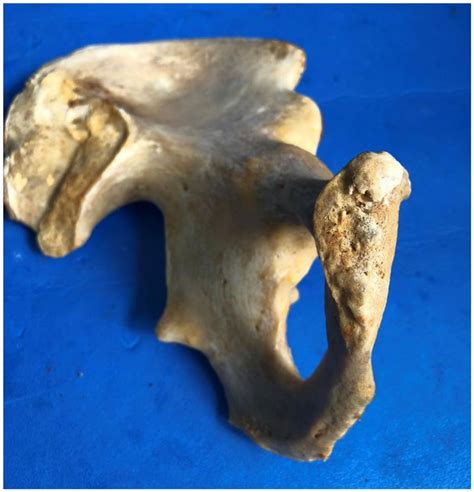 Pubic Symphysis View For Aging Estimation Download Scientific Diagram