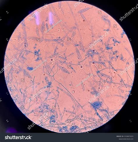 Ascomycota Microscope Yeast