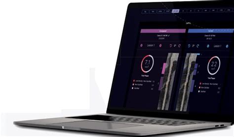 Cleerly Analysis Using The Power Of Ai Revolutionizing Heart Disease Diagnosis To Lower The