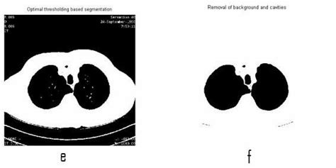 E Image Segmentation F Background Removal Download Scientific Diagram