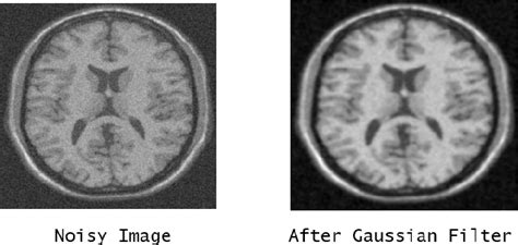 Detection And Classification Of Brain Tumors Using Deep Convolutional Neural Networks