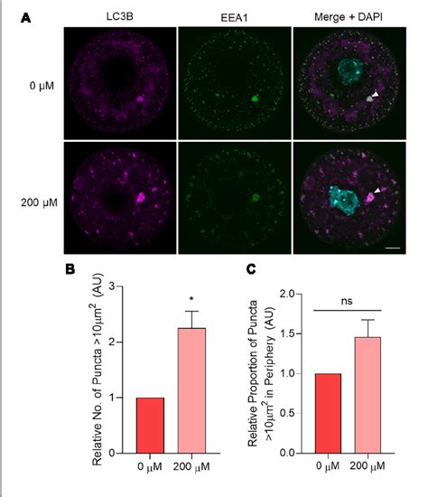 Figure 1 From The Impact Of Aging On Macroautophagy In The Pre Ovulatory Mouse Oocyte Semantic