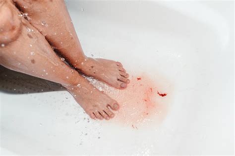 Spotting During Perimenopause Is It Normal