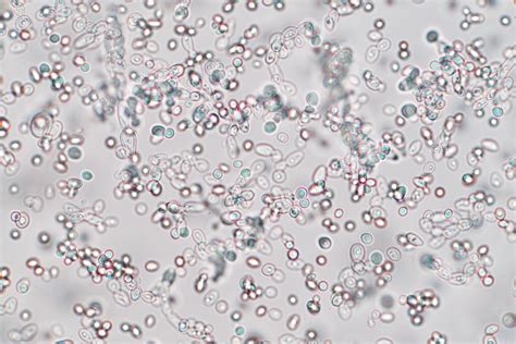 Microbial Mixology The Microorganisms Of Beer