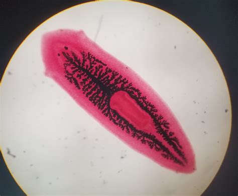 Platyhelminthes Flatworm Class Turbellaria Planaria Diagram Quizlet