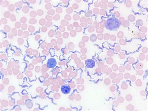 Microscopios Para Hematología De Zeiss