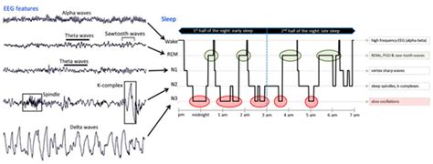 Brain Sciences Free Full Text Sleep In Disorders Of Consciousness A Brief Overview On A