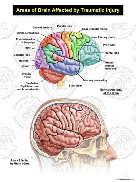 Trauma Kills Brain Cells At Jennifer Villacorta Blog