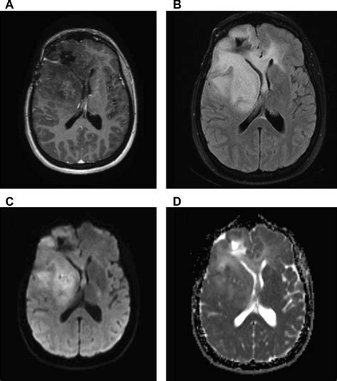 Emerging Techniques And Future Directions Magnetic Resonance Imaging