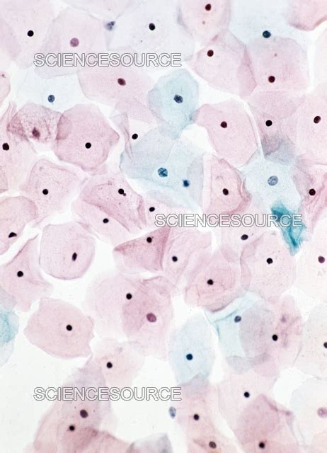 Human Vaginal Mucosa Cells Lm Stock Image Science Source Images