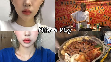 Vlog입술필러입꼬리필러and팔자필러👄일상주의입술필러브이로그 Youtube