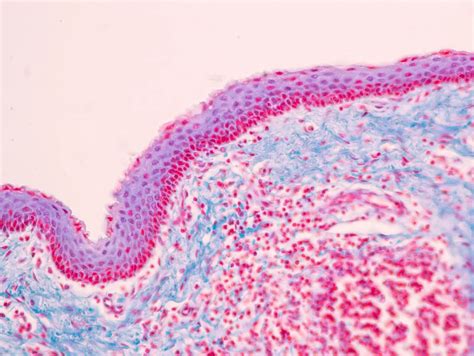 innovation grants to nurture initial translational efforts ignite development and validation