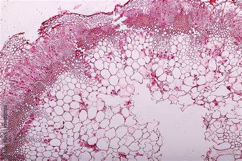 Zygomycota Or Zygote Fungi Downy Mildew Of Cruzifers Host Tissue With