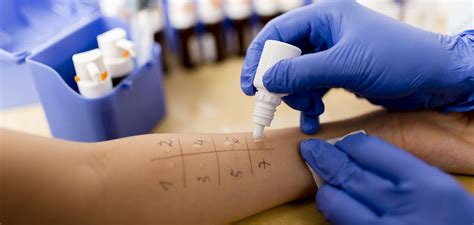 Allergy Testing