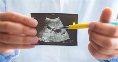 Imugene Progresses Clinical Trials Supported By Strong Cash Runway