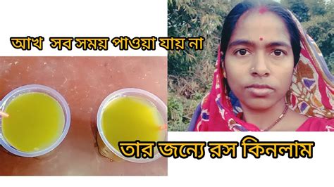 আখের রস জন্ডিসের রুগী কে খাওয়ানো খুব ভালো Youtube