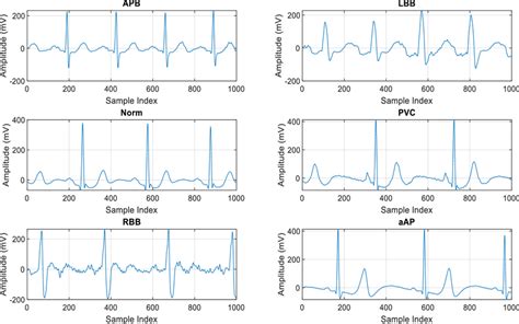 Signal Samples From Ecg Dataset Download Scientific Diagram