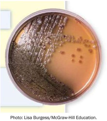 Connect Chapter Flashcards Quizlet