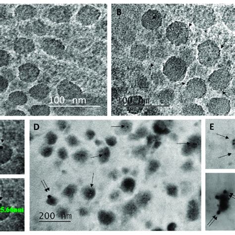 Immunogold Electron Microscopy Of Crude Small Ev Pellet From One Early