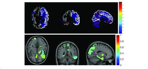 Visualization Of Top Identified Imaging Markers For Ravlt Memory