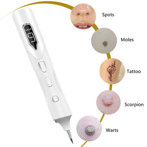 Нова лазерна плазмена писалка за премахване на етикети на кожата Лунички Черни точки Папиломи
