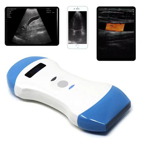 Probe 3 In 1 Color Ultrasound Scanner